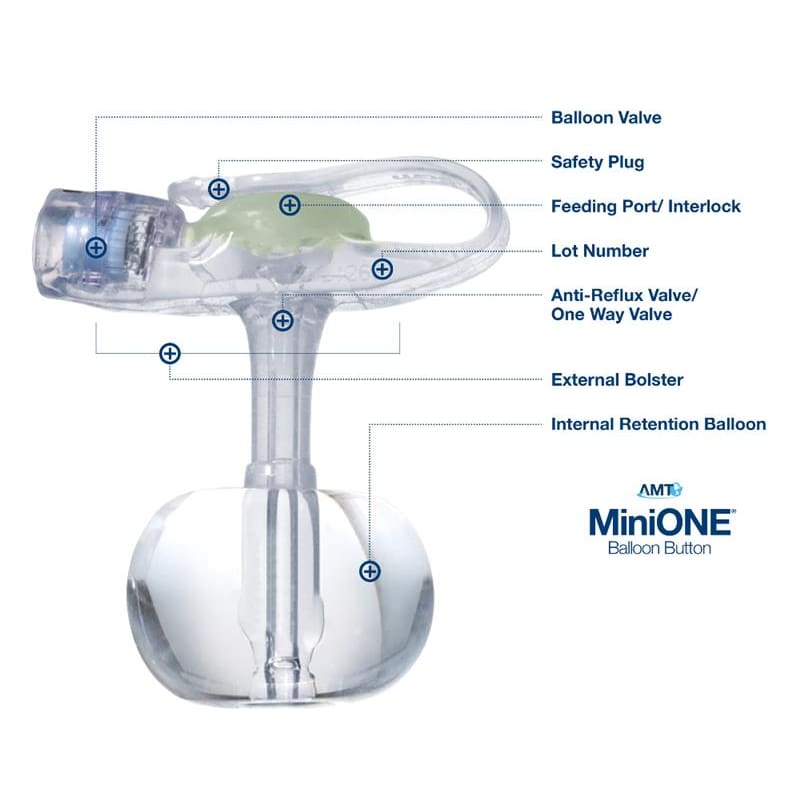 AMT Mini One Balloon Button 14Fr X 3.0Cm | ShelHealth