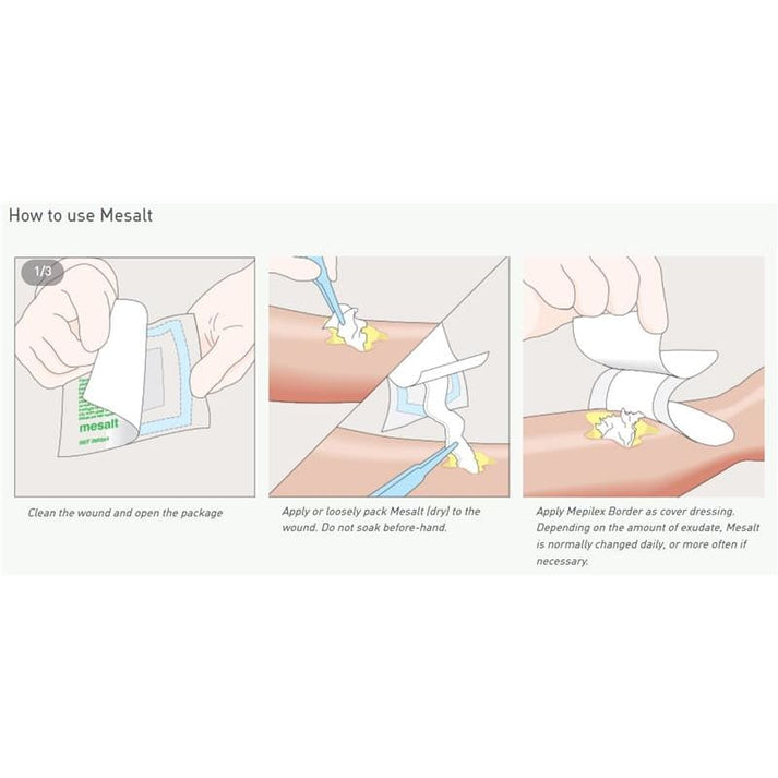 Molnlycke Mesalt Ribbon 3/4" X 39", Box of 10 | ShelHealth